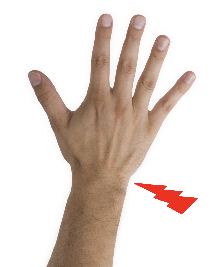 EL FIBROCARTÍLAGO TRIANGULAR - Dr. Roberto Cibantos Martínez