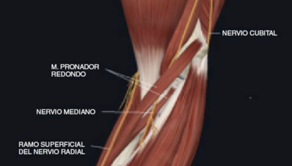 SÍNDROME DEL PRONADOR - Dr. Roberto Cibantos Martínez
